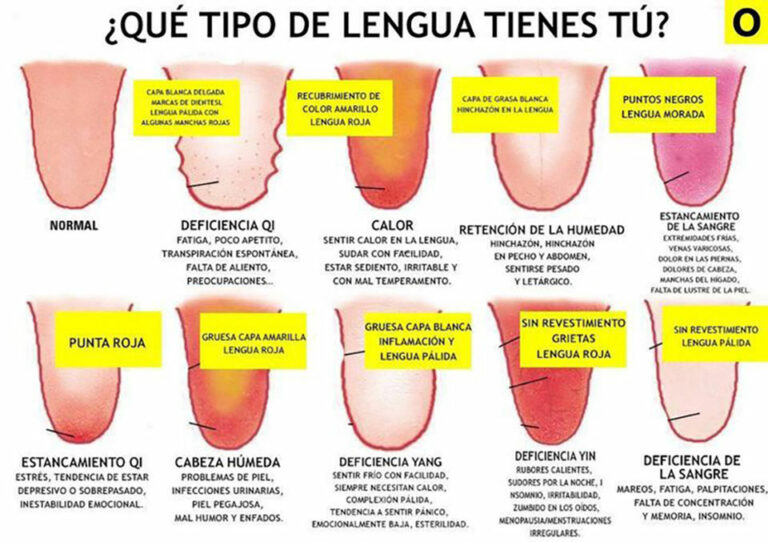 ¿Cómo está tu lengua? - Revista Integral