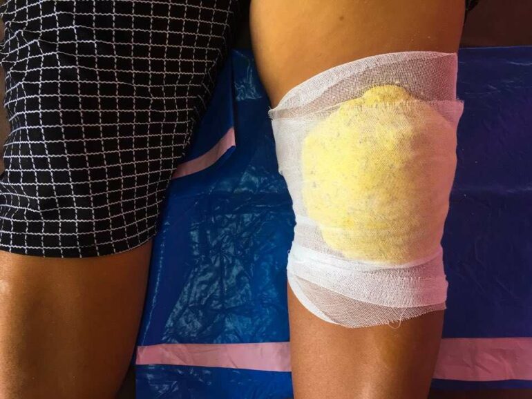 Cataplasmas y jarabes - Revista Integral